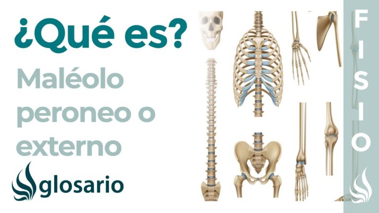 Fractura Maleolo Peroneo Sin Desplazamiento: Guía Completa de ...