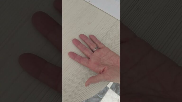 Tendones Flexores y Extensores de la Mano: Funciones, Anatomía y ...