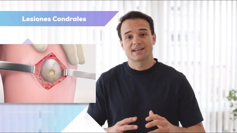 Lesión Condral en la Rodilla: Tiempo de Baja y Recuperación ...